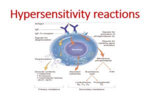 delayed hypersensitivity - Microbiology Notes