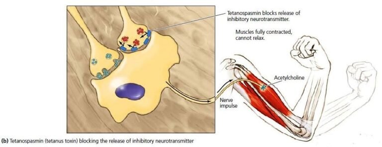 Tetanus - Etiology, Pathogenesis, and Treatment - Microbiology Notes