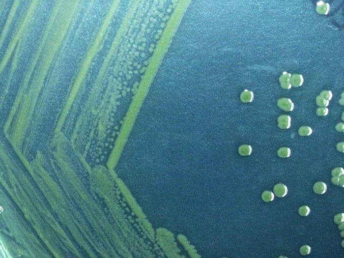 Shigella-Epidemiology, Pathogenesis, and Treatment - Microbiology Notes