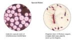Different Staining Methods used in Microbiology - Microbiology Notes