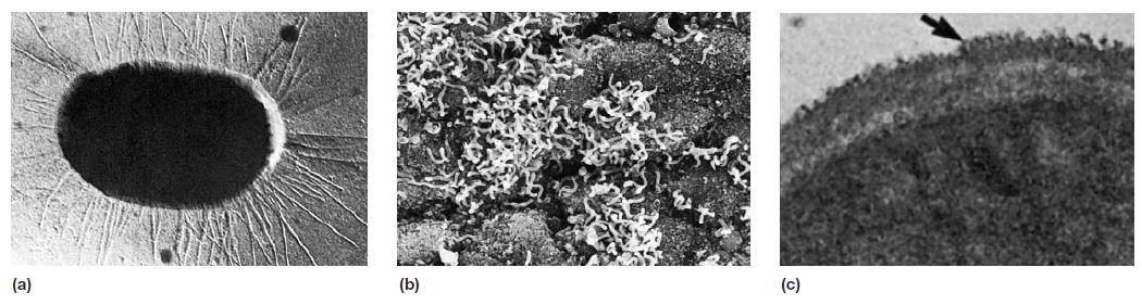 Overview of the Bacterial Pathogenesis - Microbiology Notes