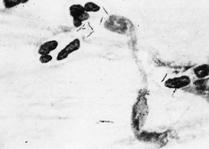 Mycobacterium tuberculosis-Epidemiology, Pathogenesis, and Treatment