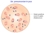 Pneumococcus: Introduction, Morphology, Diagnosis and Treatment