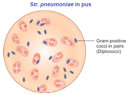 Pneumococcus: Introduction, Morphology, Diagnosis and Treatment