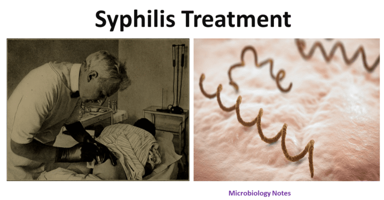 The Story of Syphilis Treatment - Microbiology Notes
