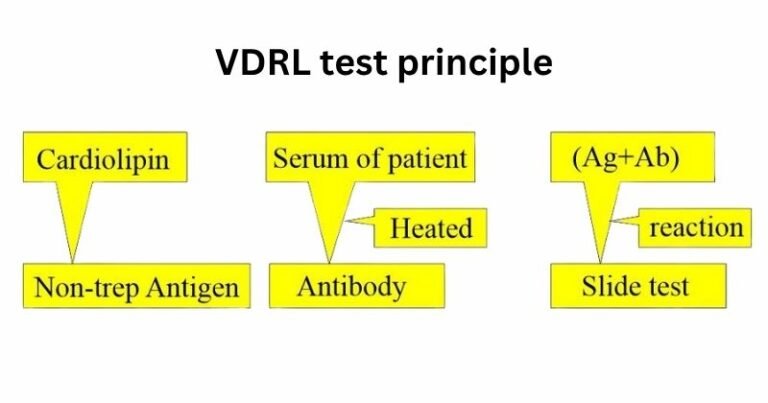VDRL Test: Principle, Procedure, Interpretation, and Applications ...