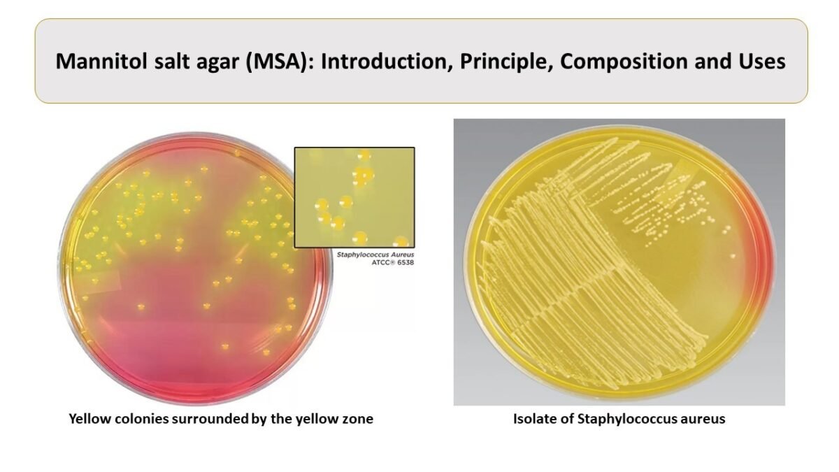 mannitol salt agar (MSA) - Microbiology Notes