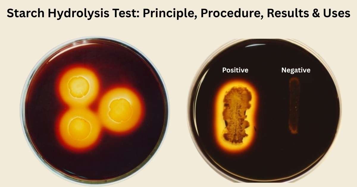 Starch Hydrolysis Test: Principle, Procedure, Results, and Uses ...