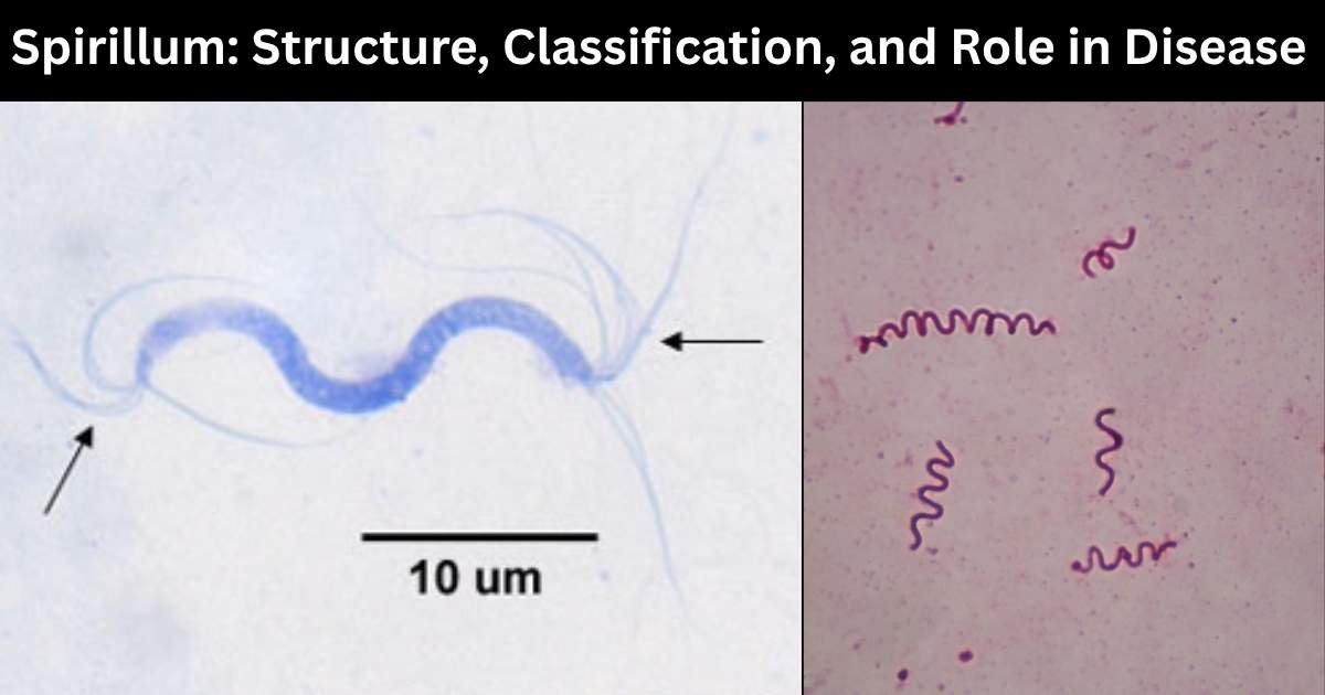 microaerophilic bacteria - Microbiology Notes