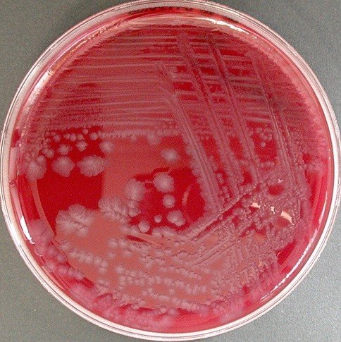 Clostridium: Morphology, Pathogenesis, Applications, and Prevention ...